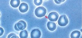 Live & Dried Blood Analysis