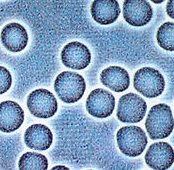 Live & Dried Blood Analysis